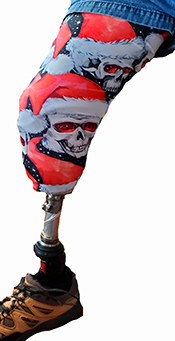 SleeveArt prosthetic sleeve covers and laminating sleeves for amputees